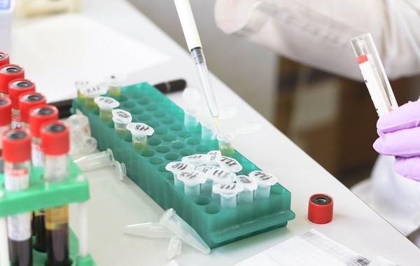 Hanmi’s lung fibrosis drug candidate wins FDA orphan drug status