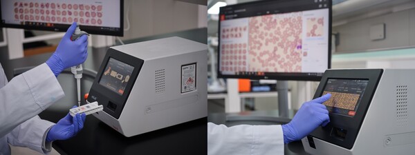 Noul wins Saudi approval for class 3 AI-backed device to aid malaria ...