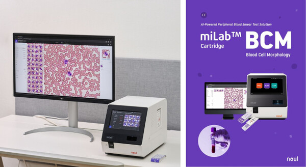 Noul signs supply agreement with Germany's Limbach for AI diagnostics
