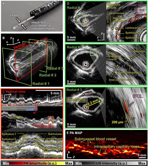 POSTECH, Yonsei Cancer Center develop 'world’s 1st' high-performance ...