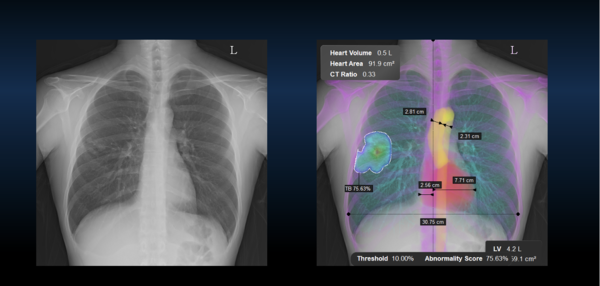 [Interview] Nvidia’s only Korean healthcare partner launches AI X-ray ...