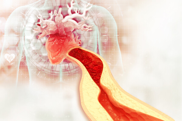 Amgen launches Korean phase 3 trial for heart drug targeting high ...