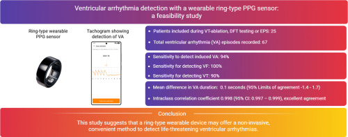 Sky Labs' smart ring detects ventricular arrhythmias with 94% sensitivity