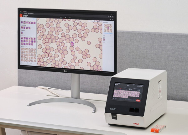 Noul wins $975,000 supply deal for AI malaria diagnostic solution in Ghana