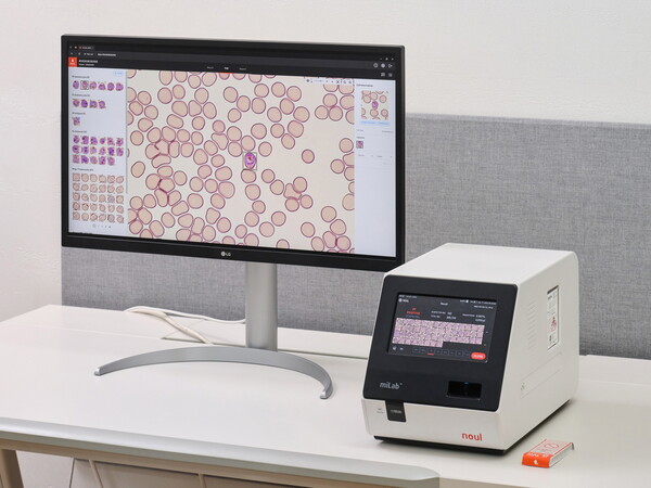 Noul supplies AI malaria diagnostic platform to Germany’s Charité Hospital