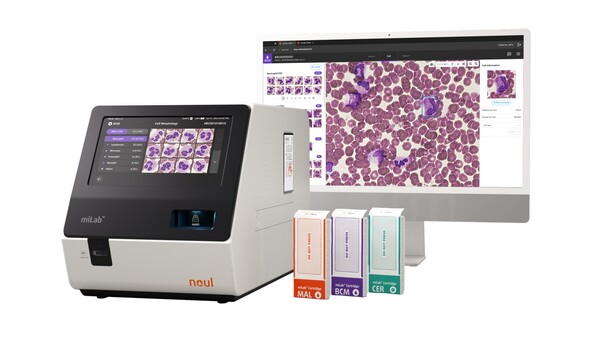 Noul expands in Eastern Europe with Romania deal for AI blood testing