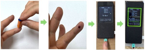 Severance team validates potassium testing using a single drop of blood