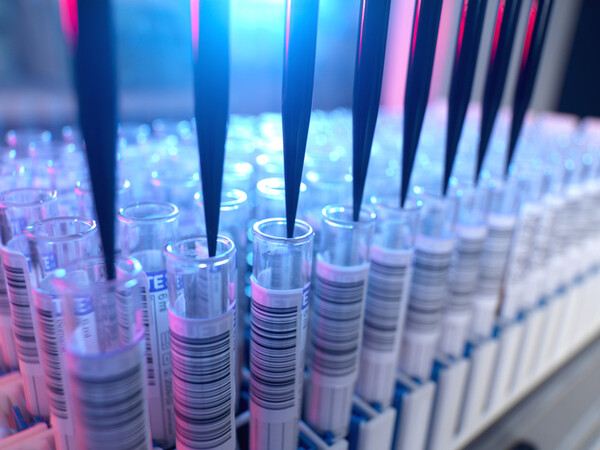Patients urge improving differential access to CAR-T therapy Yescarta ...
