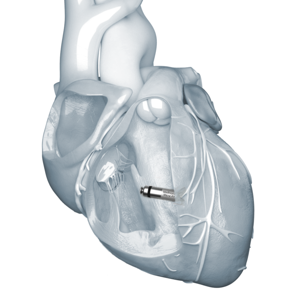 Medtronic to launch Micra VR2, AV2 leadless pacemakers in Korea