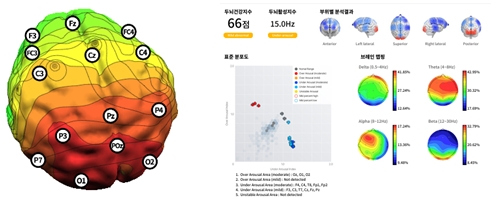 Biosignal Lab launches AI-based quantitative EEG device ‘QEEG-32FX AI’