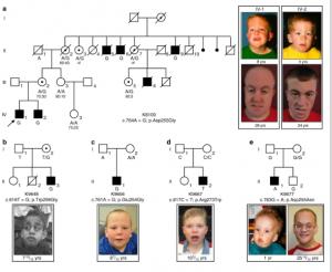 Gene related to developmental, intellectual disabilities found