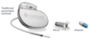 Severance doctors find leadless, micro-pacemaker effective
