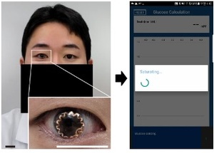 Smart contact lens developed for accurate blood glucose monitoring
