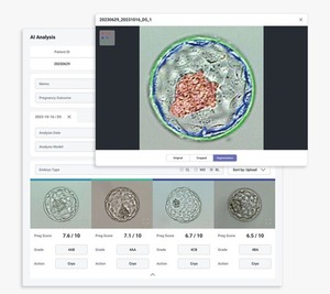Kai Health's AI-powered embryo analysis software gains innovative ...