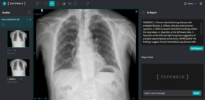 Can generative AI transform medical imaging and diagnosis?