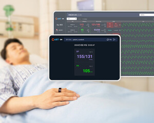 Sky Labs launches ring-shaped inpatient blood pressure monitoring solution